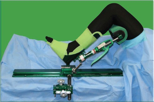 Orthopedics - Circle Star Ltd. Medical